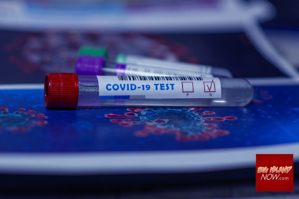 County’s Testing Center, Mobile Testing Van Implements Ticketing System ...